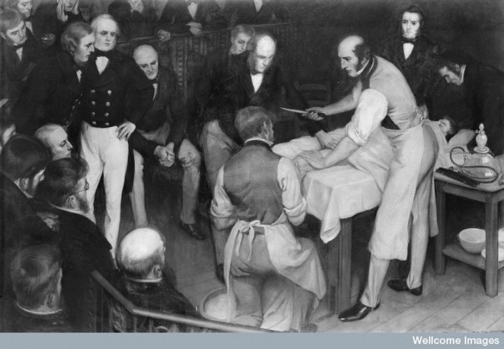 Victorian Era Amputations