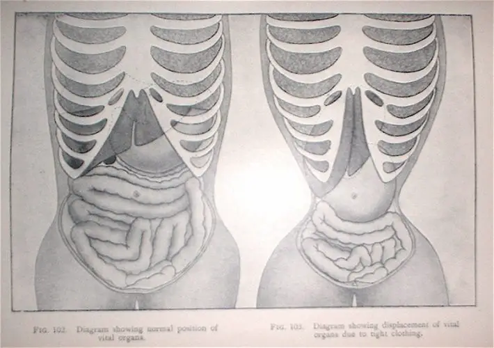 Corset: History of Corset and Corset punishment, Origin of Corset